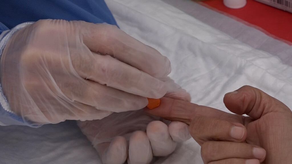 Epatite C, dal 4 settembre screening gratuito per i nati dal 1969 al 1989 - NoiTV